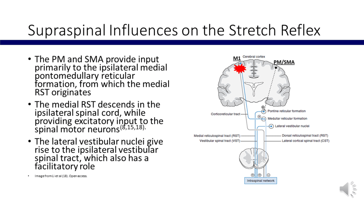 Pathophysiology of Spasticity: Supraspinal Mechanism - World Stroke Academy