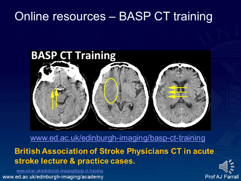 BASP CT training - World Stroke Academy