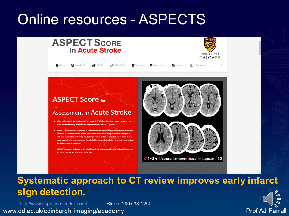 ASPECTS - World Stroke Academy