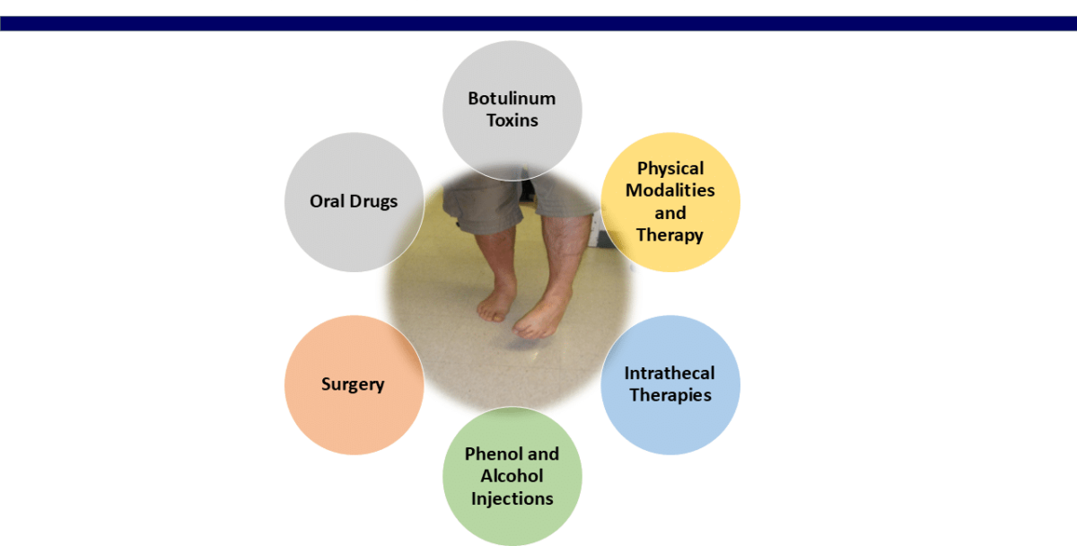 Spasticity Treatment options - World Stroke Academy